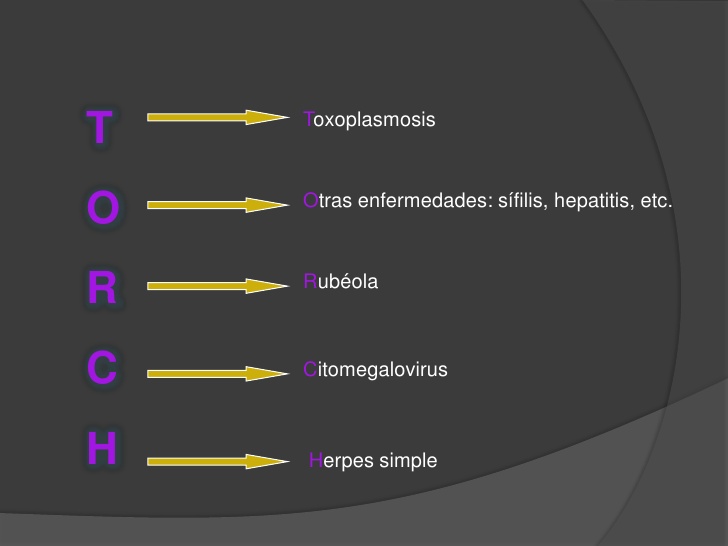 Doménica Pilco - Parasitología: Diagnóstico diferencial de Toxoplasmosis
