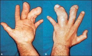 Soy Criminalista : DACTILOSCOPIA