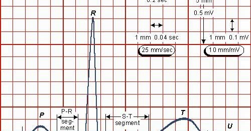Medical Addicts: Basics about ECG