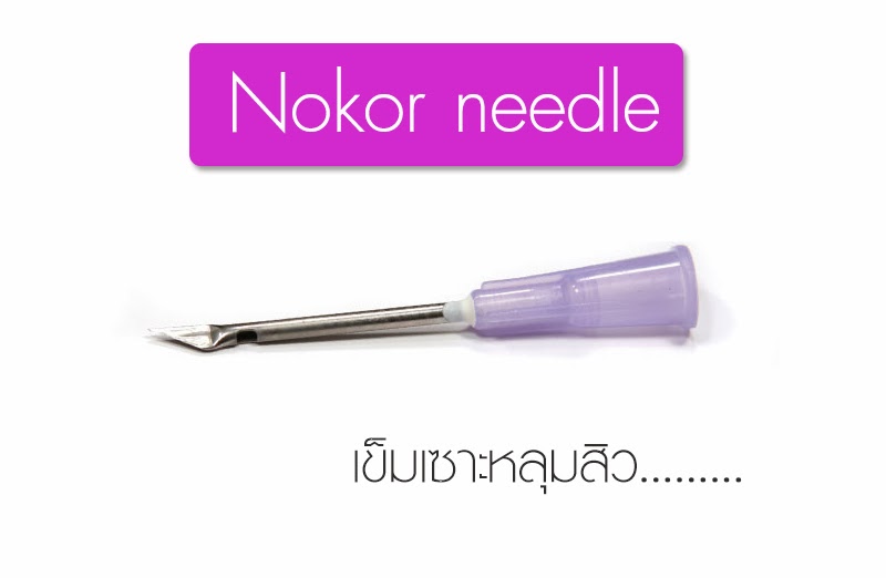 เข็ม Nokor needle กับภาระกิจกำจัดหลุมสิว(Subcision) ได้ผลมากน้อยแค่ไหน ...