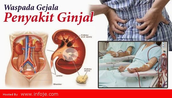 Hati-Hati Dengan 6 Jenis Makanan ini Karena Bisa Jadi Penyebab Batu Ginjal Hati-Hati Dengan 6 Jenis Makanan ini Karena Bisa Jadi Penyebab Batu Ginjal