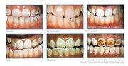 Embriología Bucodental: Biopatologías y consideraciones clínicas de la ...