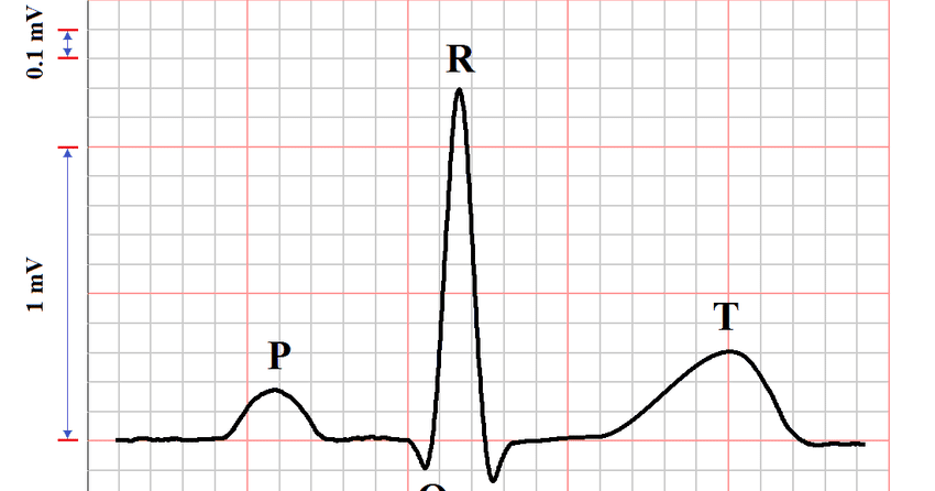 TRAYECTO PROCEDIMENTAL IV.: MENSAJE SOBRE INTERPRETAR ONDAS EN UN ECG ...