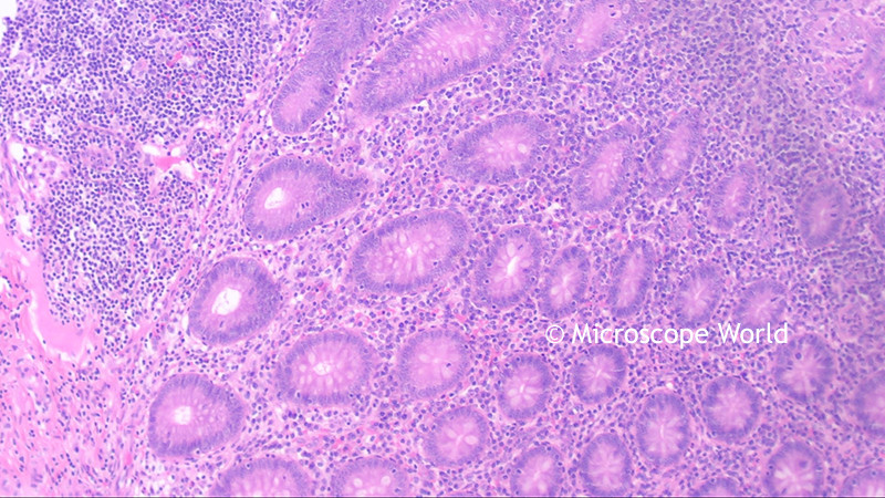 Microscope World Blog: Appendix under the Microscope