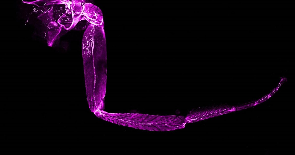 Our Parkinson's Place: The surprising link between a babies' weeble ...