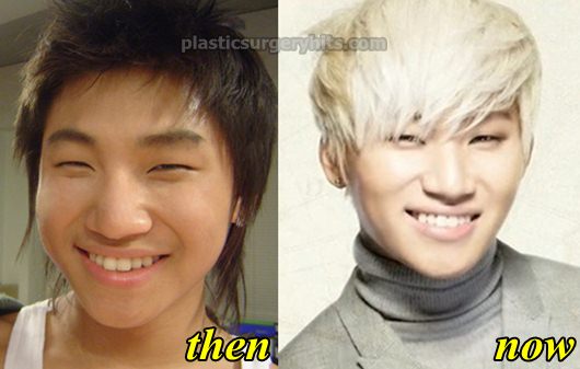 Daesung Big Bang Plastic Surgery - Did Daesung Big Bang Get Plastic ...