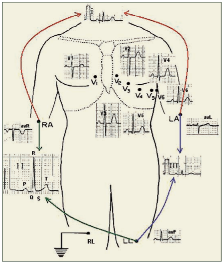 The Site for Healthcare Professionals: ECG (Electrocardiogram).