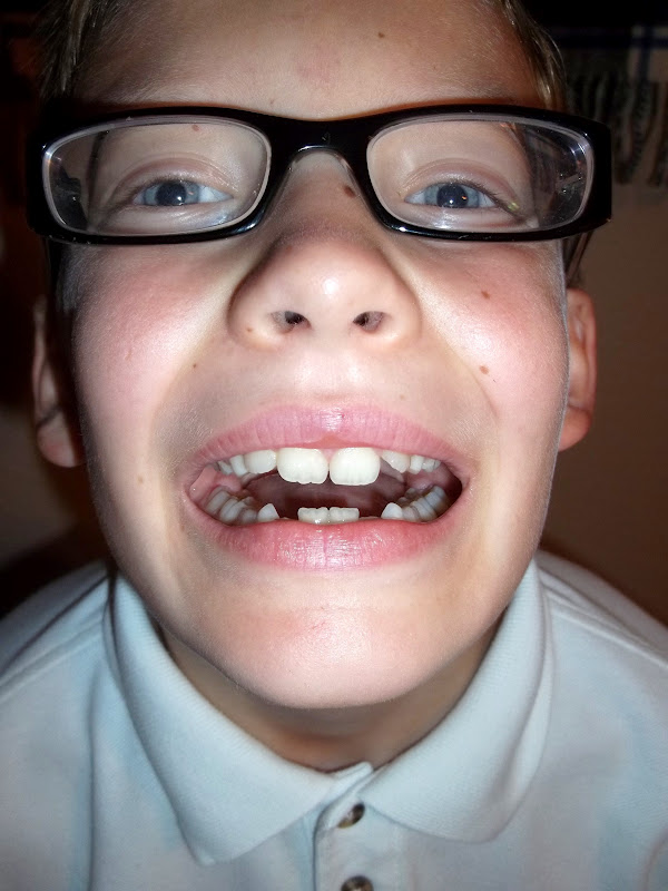 Williams Family: Big Boy Teeth