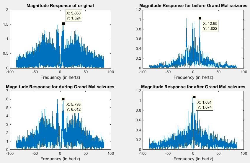 Biomedical Signal and Image Processing projects using Matlab and ...