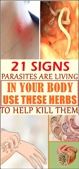 21 Signs That Your Body Is Full of Parasites - wellness magazine