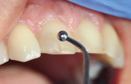 Pulp Vitality Tests with Classification and Recent Advances