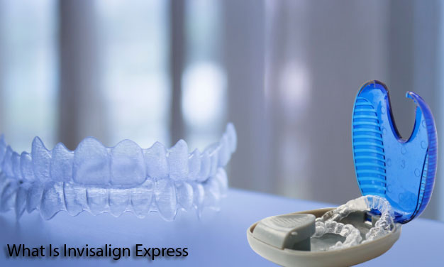 What Is Invisalign Express and Express Cost - Job in Qatar