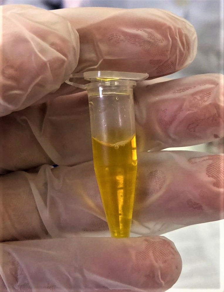 Práctica 5. Determinación cuantitativa de glucosa. Glucosa-TR 17/10/2019
