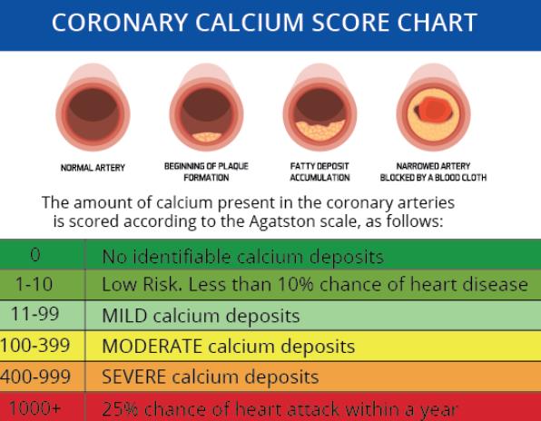 Agatston Coronary Artery Calcium Score