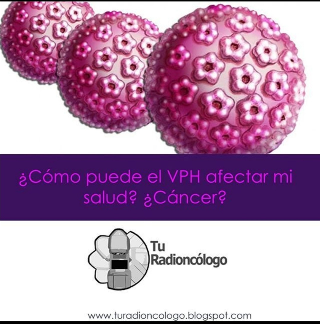 ¿Cómo puede el VPH afectar mi salud? ¿Cáncer?