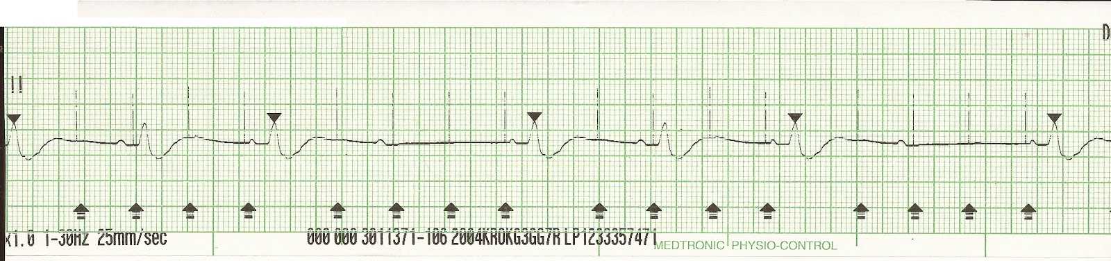 Electrical Interventions