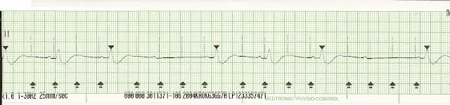 Electrical Interventions