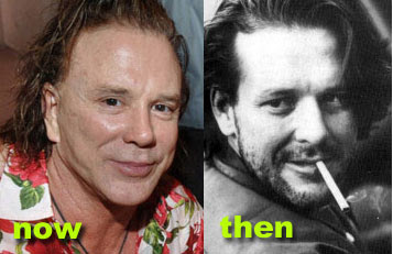 Mickey Rourke Plastic Surgery Before and After Photos - Star Plastic ...