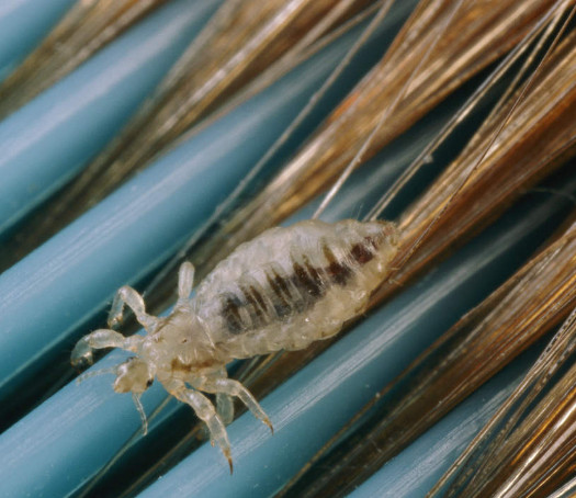 How To Get Rid Of Lice Fast - Caraway Seeds Health Benefits