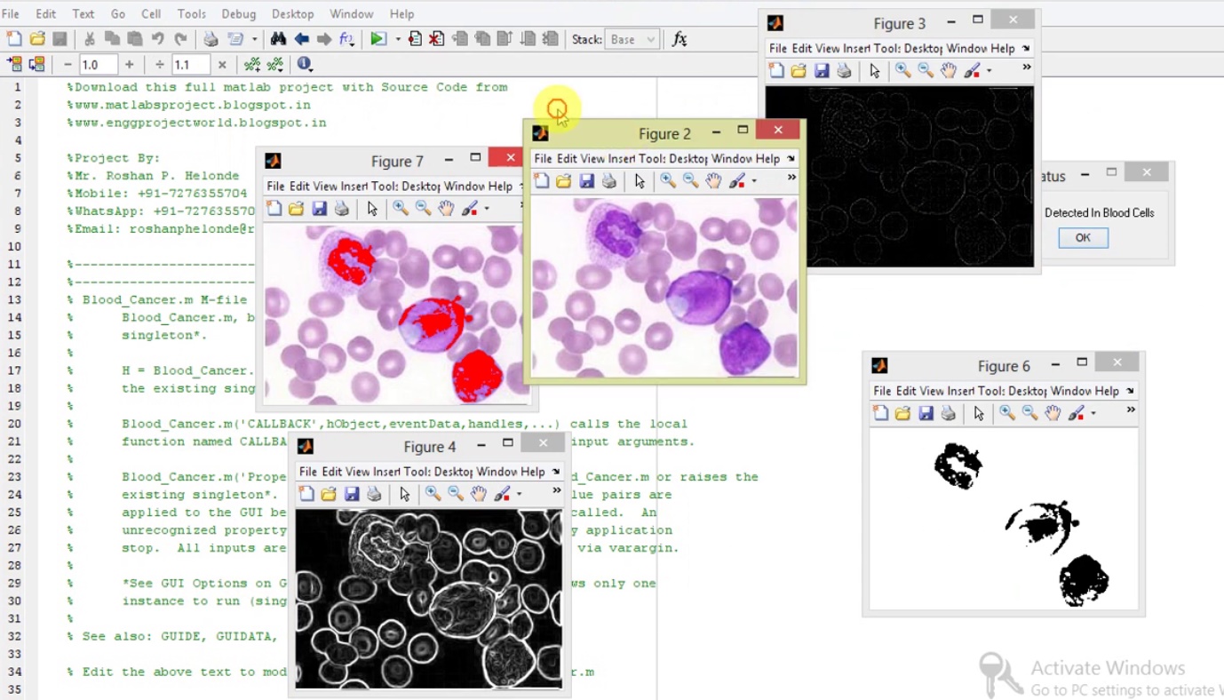 Matlab Code for Blood Cancer (Leukemia Cancer) Detection using Image ...