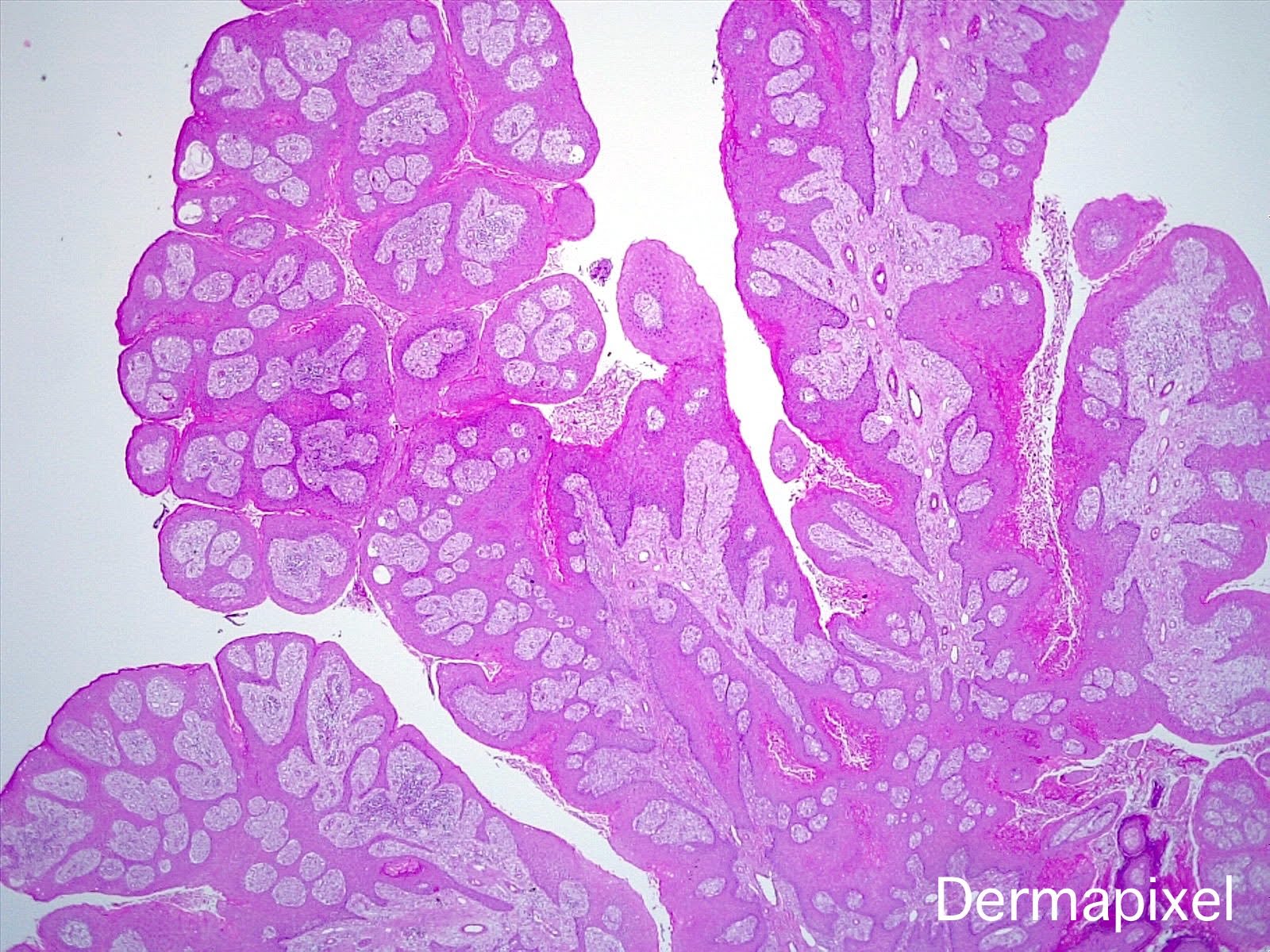 Dermapixel: marzo 2021