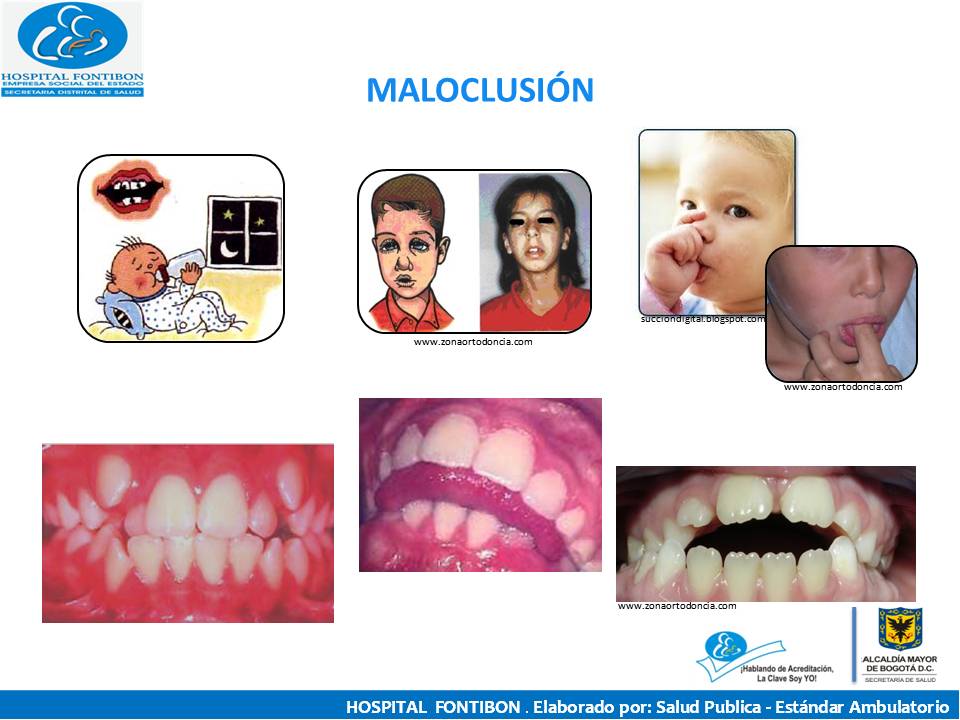 Ambito IPS: ROTAFOLIO DE SALUD ORAL
