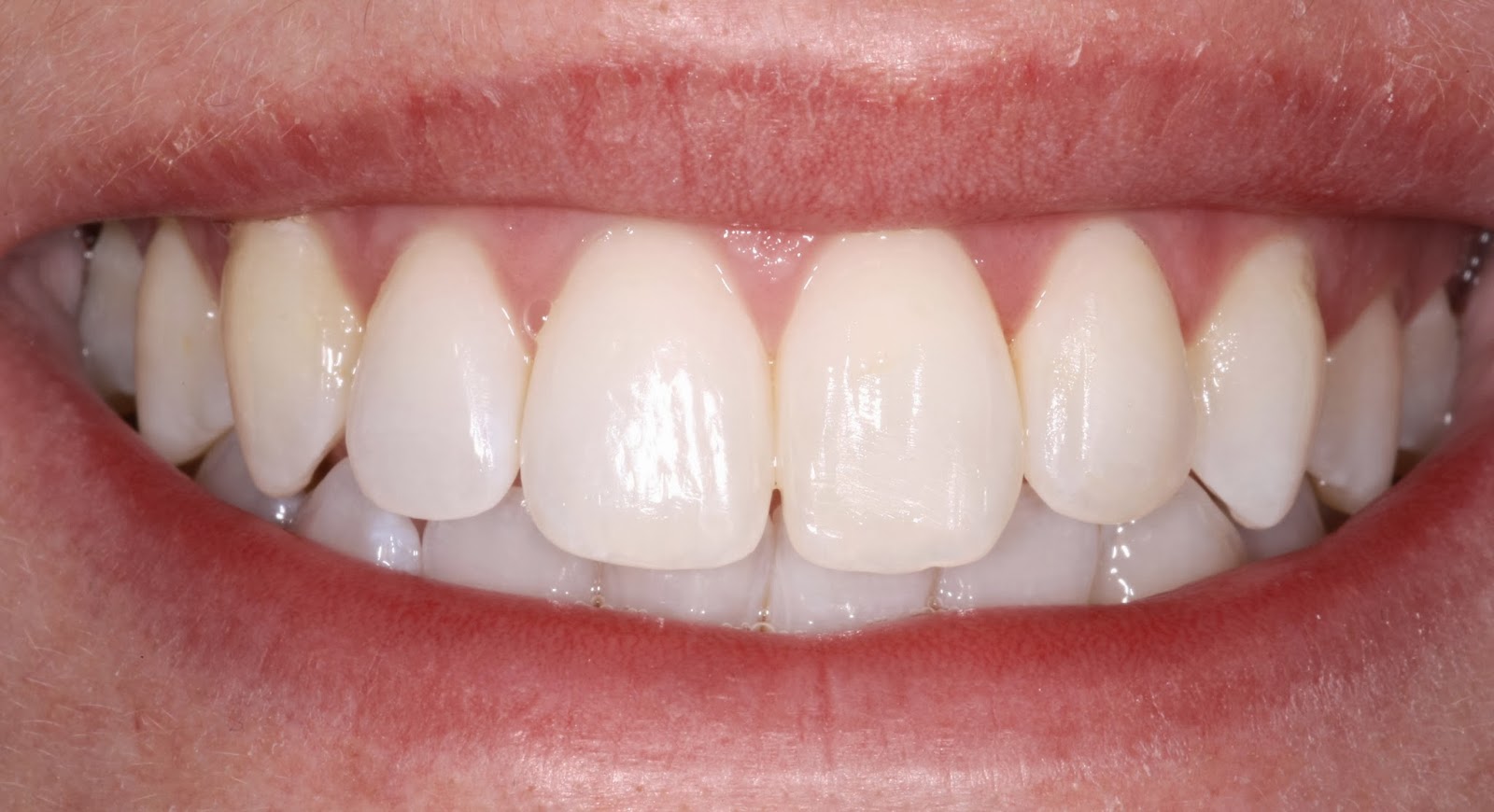 Crescent Dental on Blogspot!