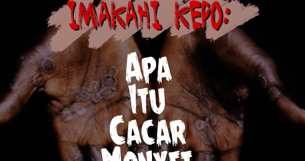 IMAKAHI UNAIR