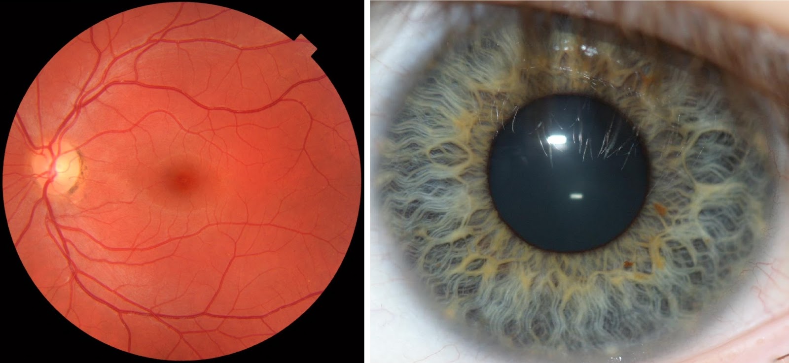 Teknologi Biometrik: dari Sidik Jari, Iris Mata, hingga Suara - Sains Ph.D