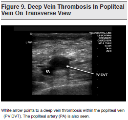 MEDICAL ULTRASOUND/DVT