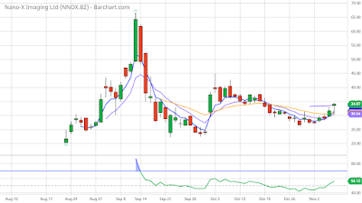 NNOX Nano-X Imaging Ltd | Financial Markets | Before It's News