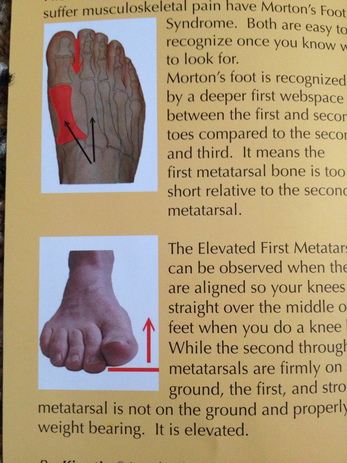 Cheryl MovingInBalance: Follow up to TRT Race Report: Ok, maybe it's ...