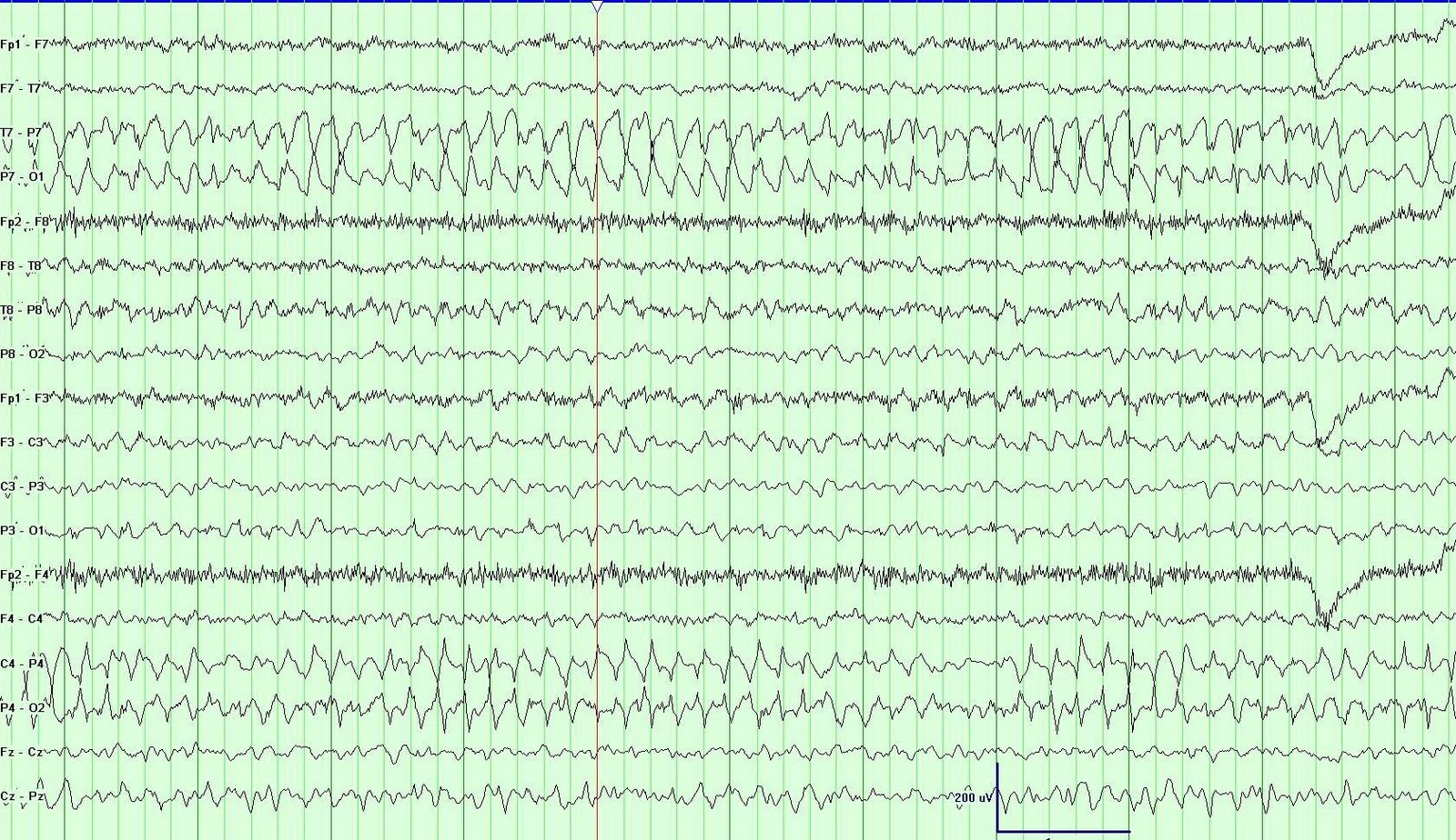 EEG Reviewer: EEG No. 12