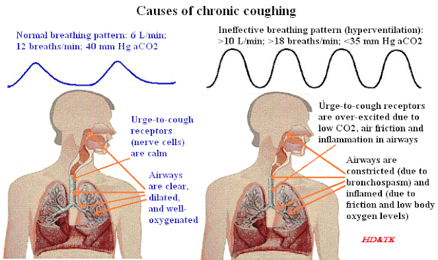 Chronic Cough