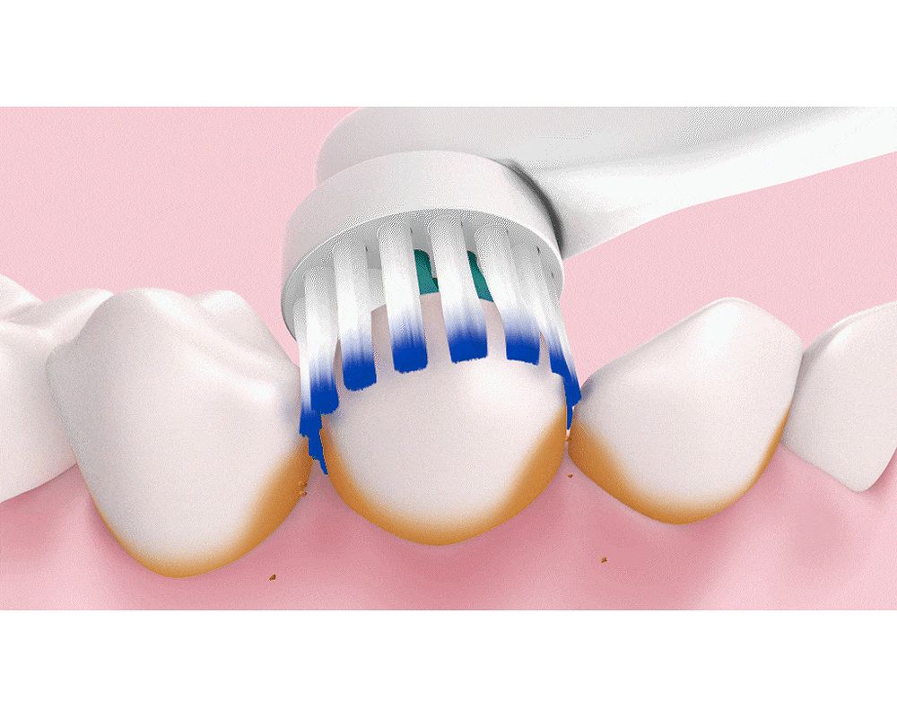 ¿Cómo usar correctamente el cepillo eléctrico? - OdontoVida