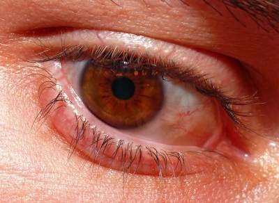 Entre cremas y tiritas: Ojo al sol
