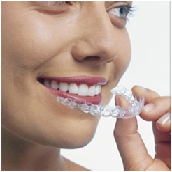 RiteBite Orthodontics: Tips on Removing your Invisalign Aligners