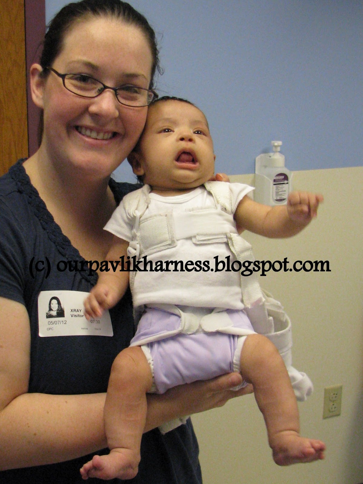 Our Pavlik Harness and journey with Hip Dysplasia: CAST