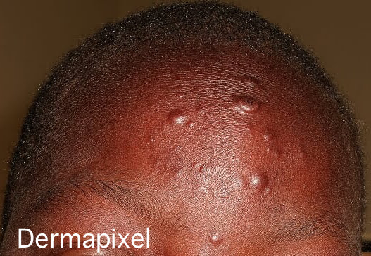 Dermapixel: enero 2020