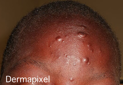 Dermapixel: enero 2020