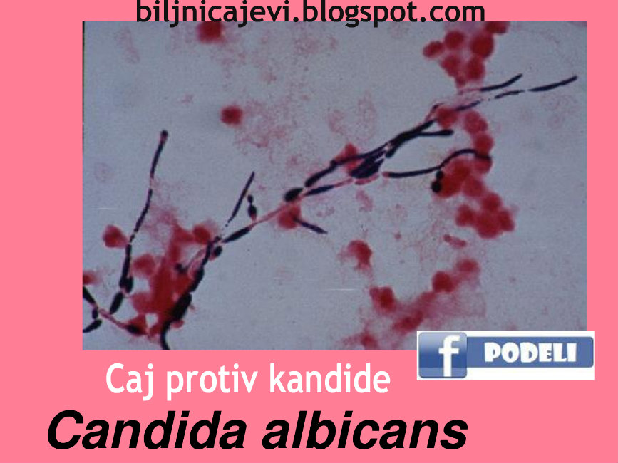 Biljni Cajevi(lekovito bilje,cajne mesavine): Caj protiv kandide