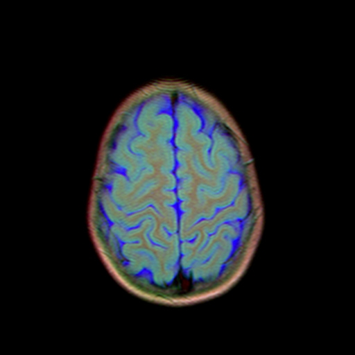 Nevit's blog: Color MRI of the Brain