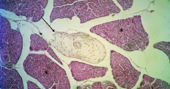 Atlas Histológico UNIFOR-MG: Corpúsculo de Vatter Pacini