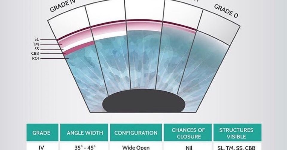 Ophthalmology Notes: Shaffer system- Gonioscopy