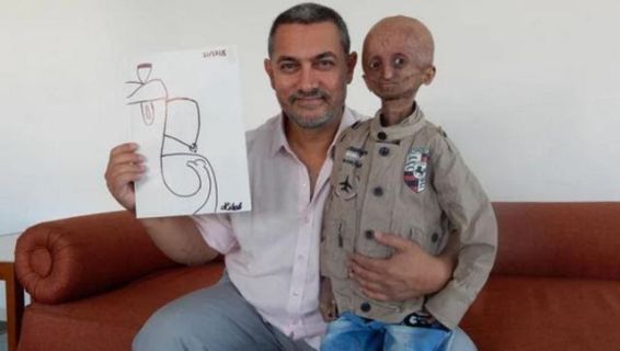 Photos 15 year old Indian Boy Who Suffered From Rare Genetic Disorder That Made Him Look 60 photos-15-year-old-indian-boy-who-suffered-from-rare-genetic-disorder-that-made-him-look-60