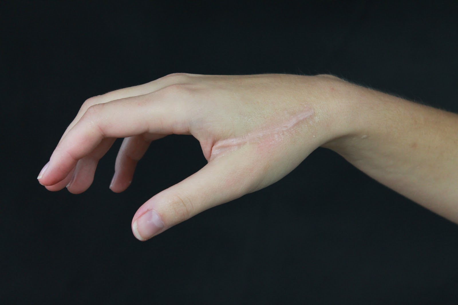 Valertine Myland: Rany, rany, rany...