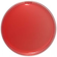 Media Mac Conkey Agar (MCA) ~ Medical Laboratory Technologist