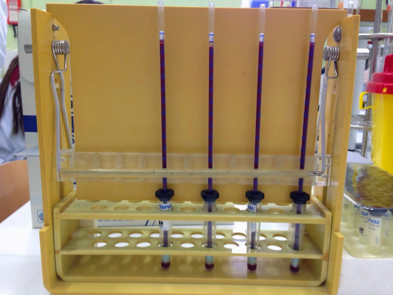 Exame Vsg Para Que Serve - RETOEDU