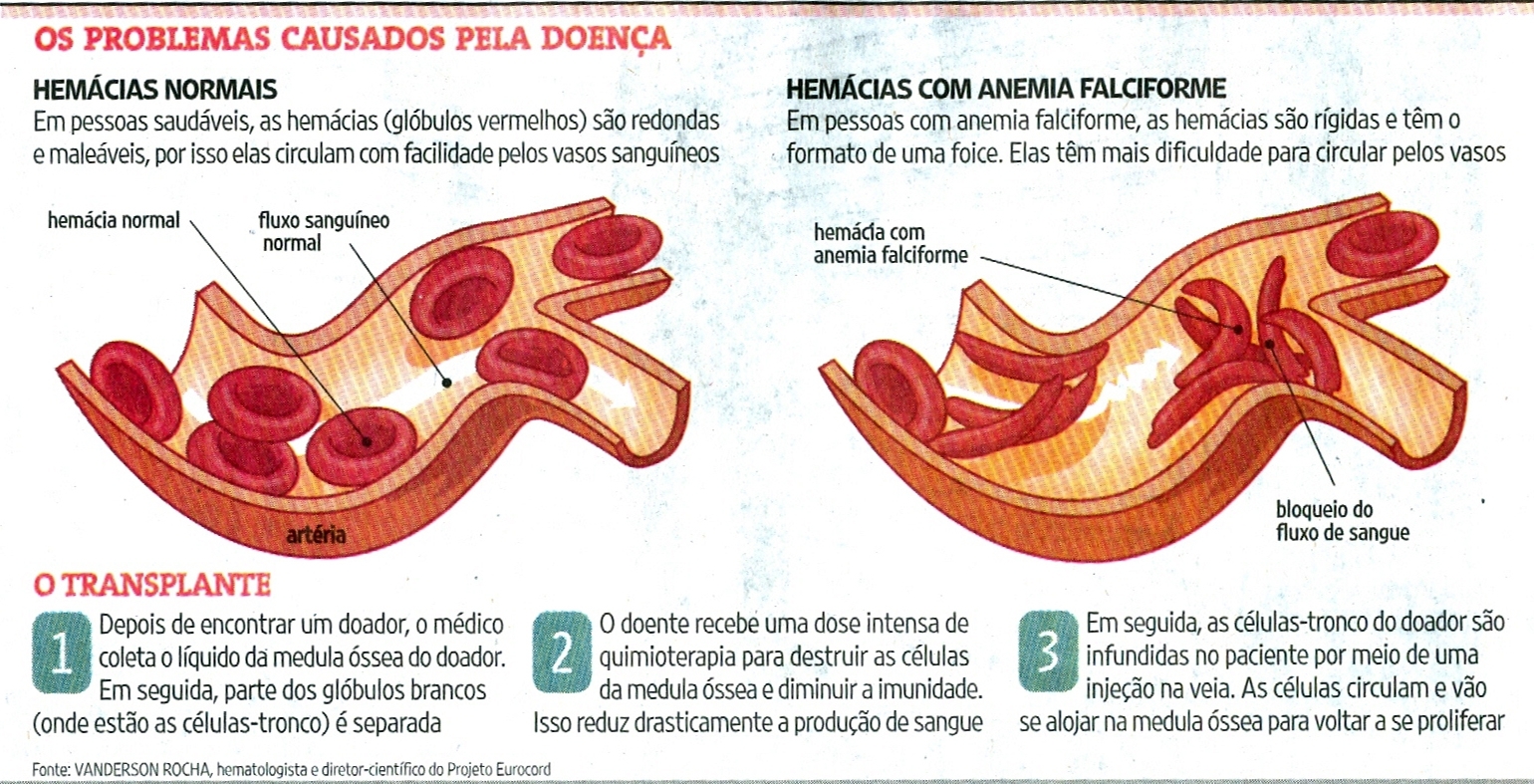 P A T H O S: Tecido Sanguíneo - Anemia