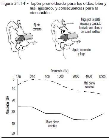 ERGONOMIA e HIGIENE INDUSTRIAL: Orejeras